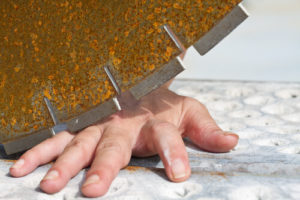 Morristown Table Saw Injury Lawyers | The Terry Law Firm